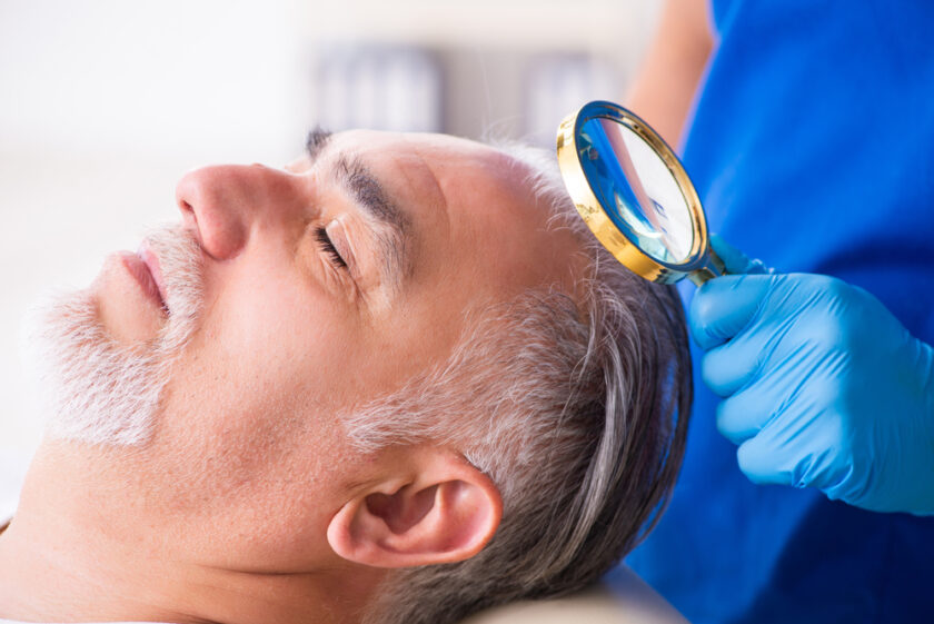 3 Tips for Finding the Best TED Hair Restoration in DC - Cosmetic ...